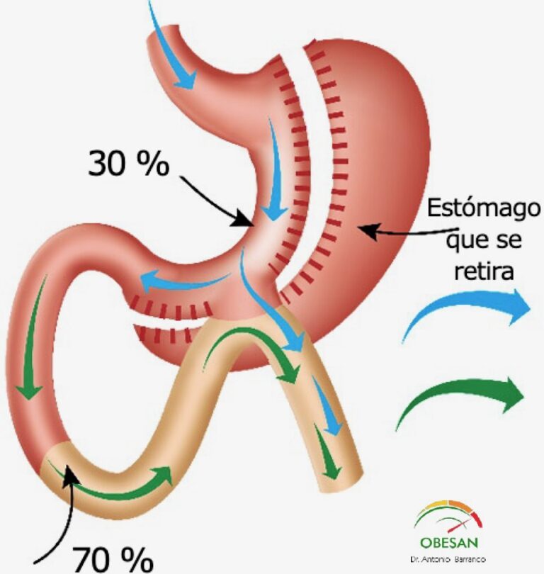 Bipartición intestinal: replica de forma natural el efecto de fármacos